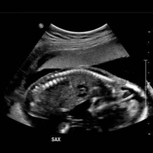 Stream fetal position by moral revulsion of morion | Listen online for ...