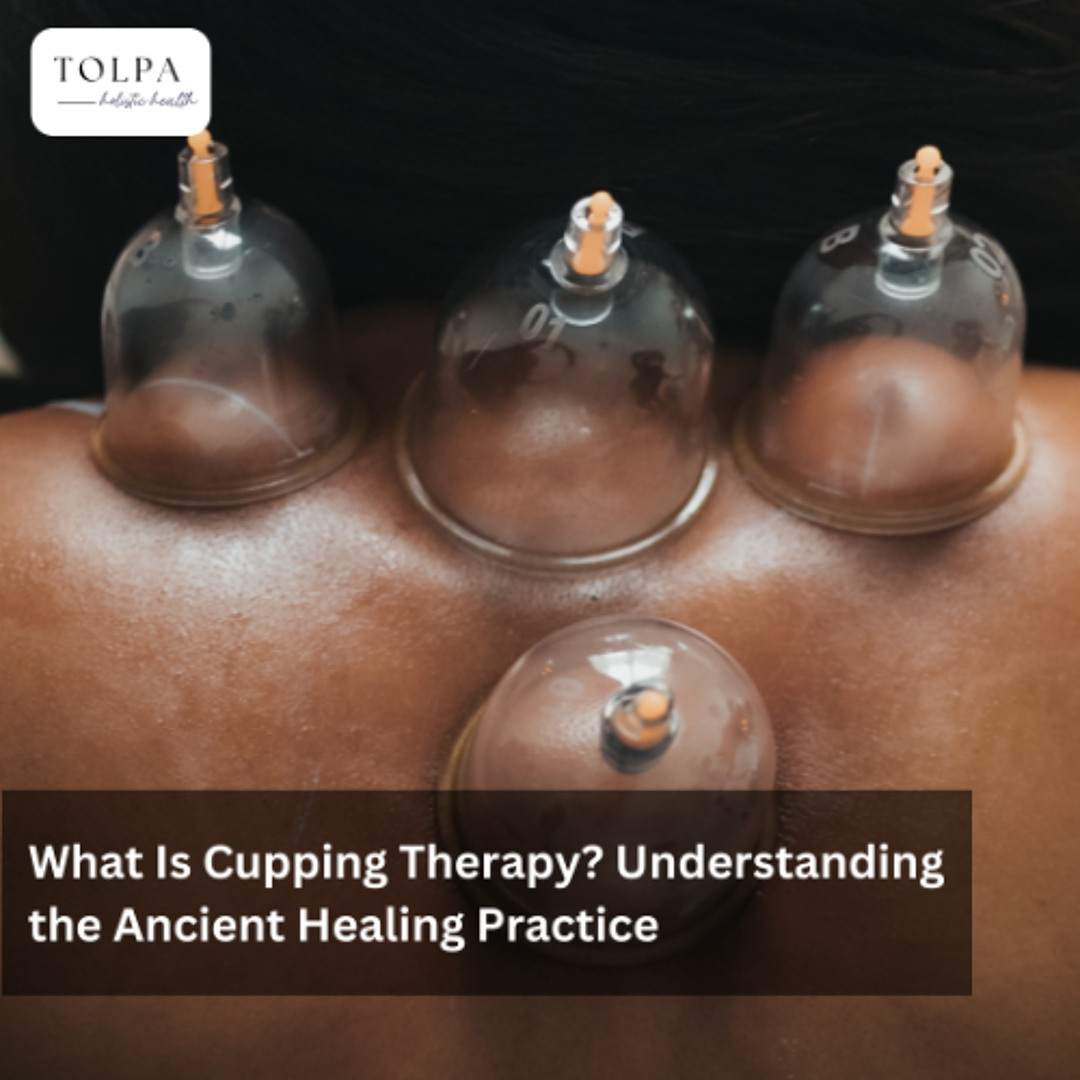 Stream What Is Cupping Therapy? Understanding the Ancient Healing ...