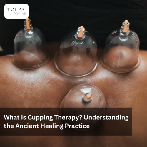 Stream What Is Cupping Therapy? Understanding the Ancient Healing ...