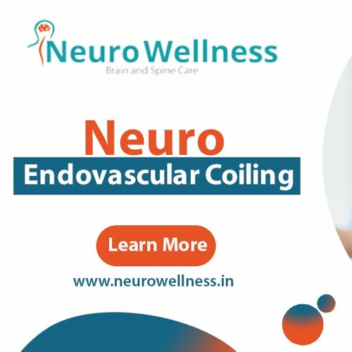 Stream episode Neuro Endovascular Coiling by Neuro Wellness podcast ...