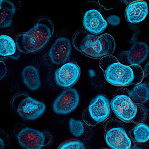 Stream Microspores music | Listen to songs, albums, playlists for free ...