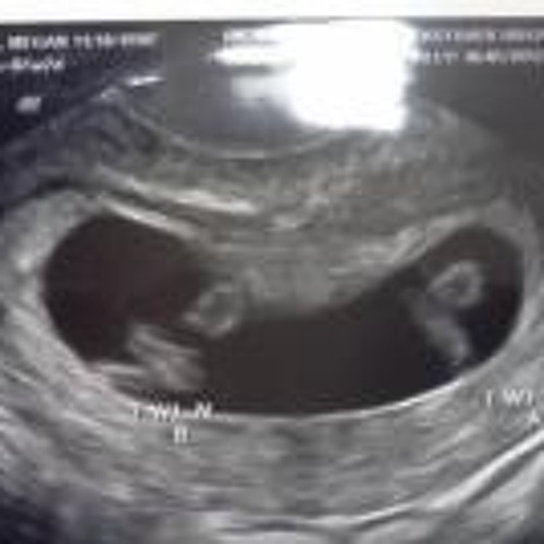 Stream Megan Youmans music | Listen to songs, albums, playlists for ...