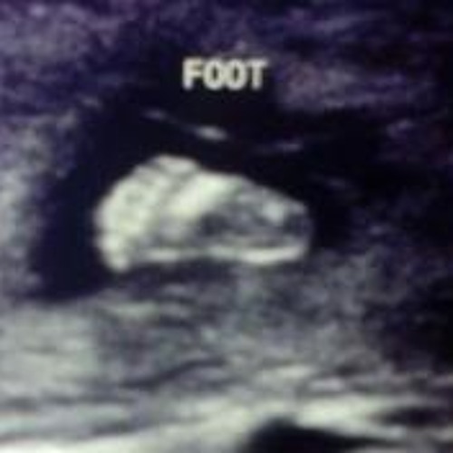 Stream Adrianne Anderson music | Listen to songs, albums, playlists for ...