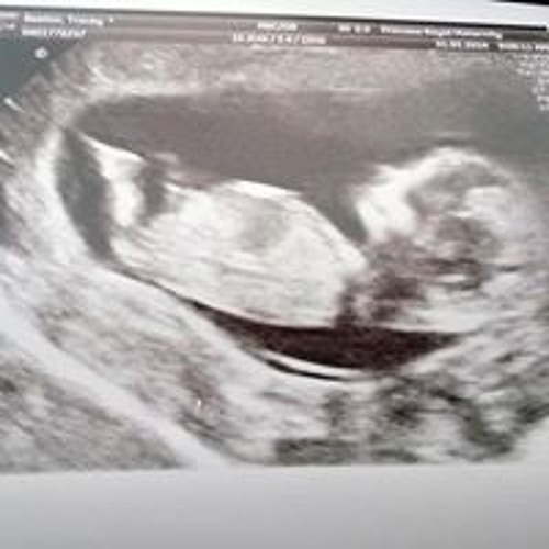 Stream Tracey McLean Beaton music | Listen to songs, albums, playlists ...