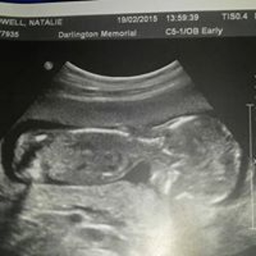 Stream Natalie Louise Rowell music | Listen to songs, albums, playlists ...