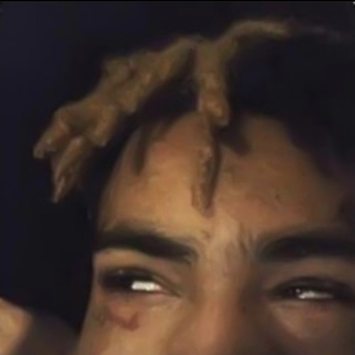 Stream Xxxtentacion Ex Bitch Acapella By Xxxtentacles Listen