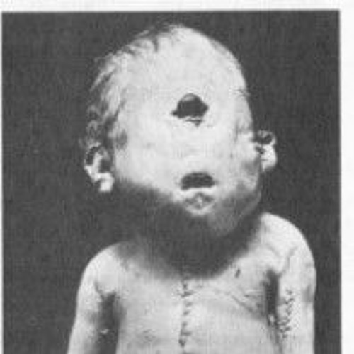 Stream fetus munchers music | Listen to songs, albums, playlists for ...