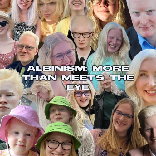 Stream Albinism: More Than Meets the Eye music | Listen to songs ...